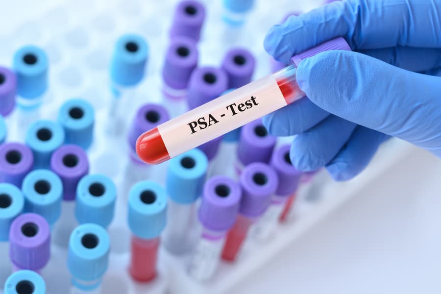 Small Cell Prostate Cancer Treatment Near You in NJ, CT, & MA